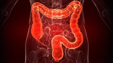 Electrocautery Technique: Approach Considerations, Pinpoint Cautery ...