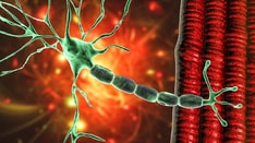 Spinal Muscular Atrophy: 5 Things to Know