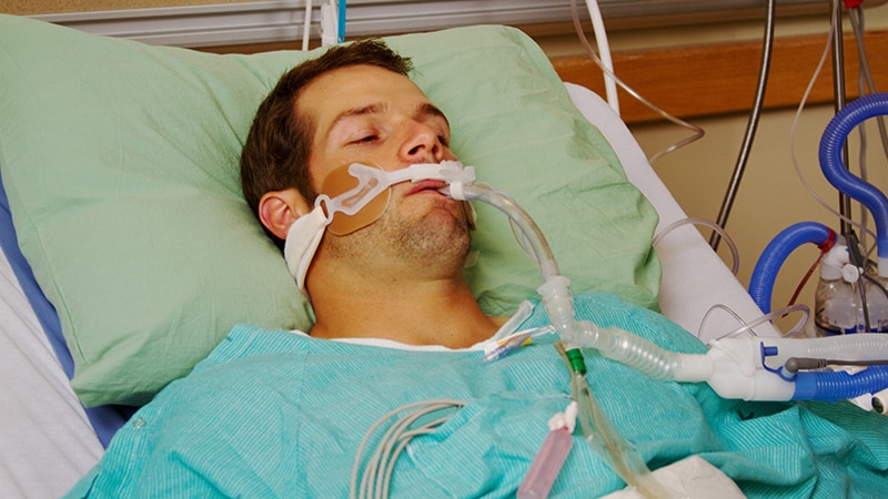 Mechanical Ventilation | Medscape