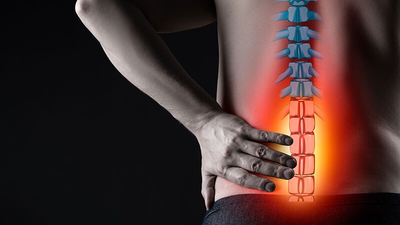 Spinal Disorders | Medscape
