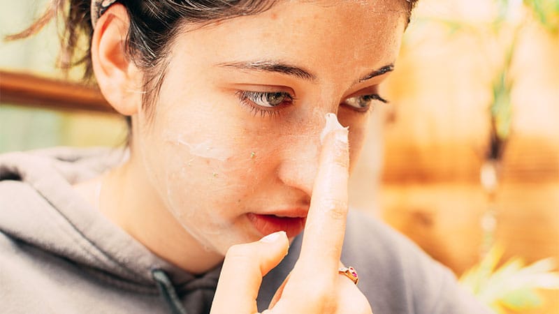 Atopic Dermatitis | Medscape