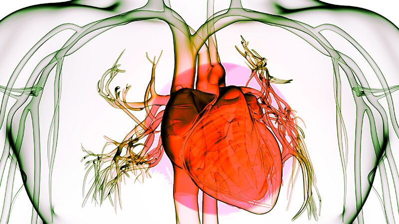 Acute Coronary Syndromes | Medscape