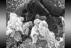 Intestinal Flukes: Background, Pathophysiology, Epidemiology