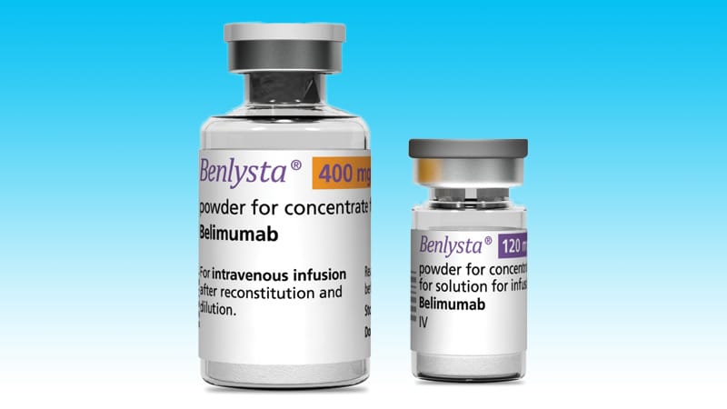 Systemic Lupus Erythematosus | Medscape