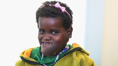 Nulojix (belatacept) dosing, indications, interactions, adverse effects ...