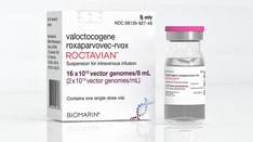 Factor V Deficiency Workup: Laboratory Studies, Imaging Studies