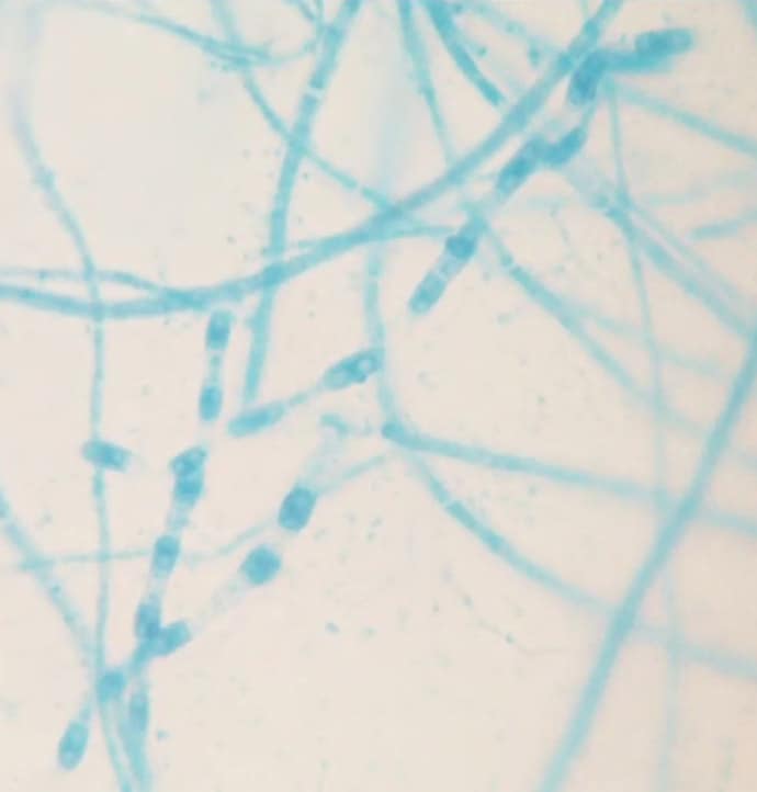 Recent Immigrant With Altered Mental Status and Seizures - Page 3