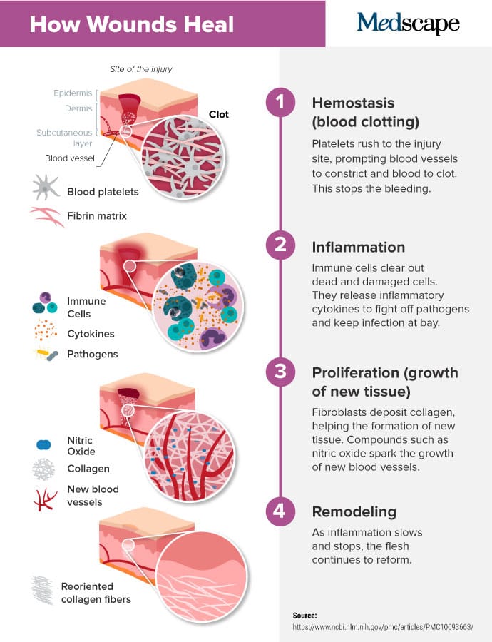 New AI-Enhanced Bandages Poised to Transform Wound Treatment - Medical ...