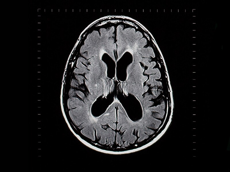 Congress of the European Committee for Treatment and Research in ...