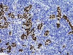 Aredia (pamidronate) dosing, indications, interactions, adverse effects ...