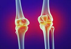 Endocrine Myopathies: Background, Pathophysiology, Epidemiology