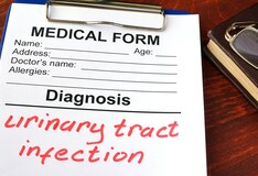 Typical Bacterial Pneumonia Imaging: Practice Essentials, Radiography ...
