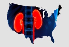 Azotemia Workup: Laboratory Studies, Ultrasonography, Computed ...
