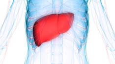 Efimosfermin Leads to Significant MASH Improvement