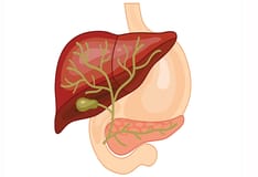 Choledochal Cysts: Practice Essentials, Background, Pathophysiology