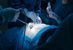 Operative Laparoscopy: Overview, Periprocedural Care, Technique