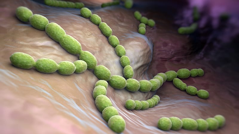 Multiple Myeloma | Medscape