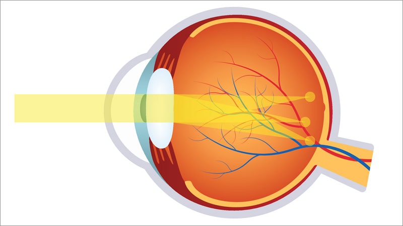 Ophthalmology - Medscape