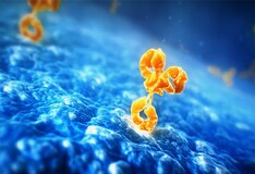 Thrombotic Thrombocytopenic Purpura (TTP): Practice Essentials ...