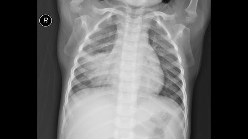Radiology - Medscape