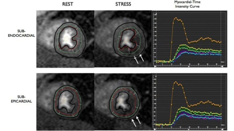 CV Imaging | Medscape