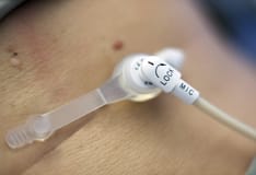 Medication Administration Through Enteral Feeding Tubes