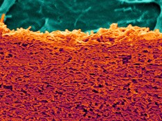 Zinplava (DSC) (bezlotoxumab) dosing, indications, interactions ...