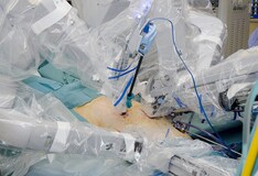 Prostate Biopsy Technique: TRUS-Guided Biopsy of Prostate, Complications