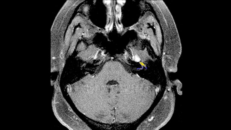 Optometry | Medscape