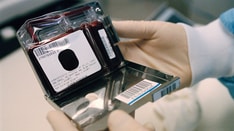 Atgam, ATG equine (antithymocyte globulin equine) dosing, indications ...