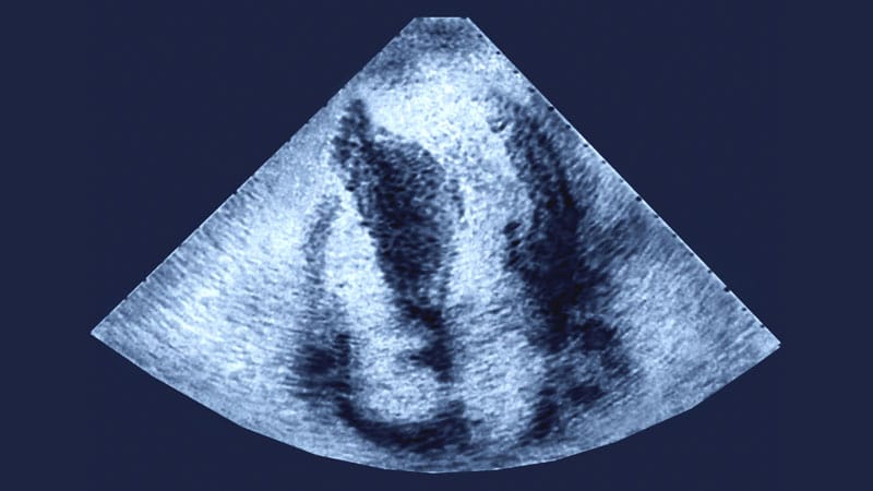 Atrial Fibrillation Center of Excellence | Medscape