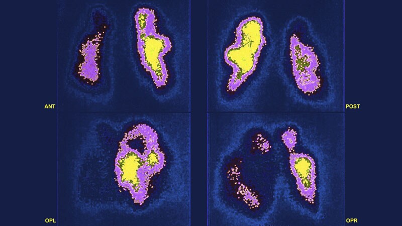 Latest Medical News, Clinical Trials, Guidelines - Today on Medscape