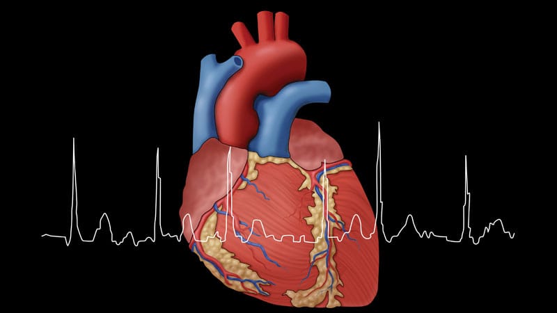 Atrial Fibrillation Center of Excellence | Medscape