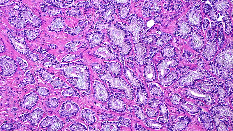 Latest Medical News, Clinical Trials, Guidelines - Today on Medscape