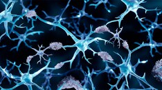 Cholinesterase Inhibitors in Early Alzheimer’s Disease