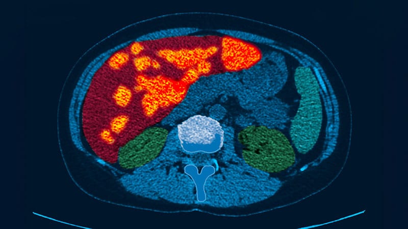 Metastatic Breast Cancer Center of Excellence | Medscape