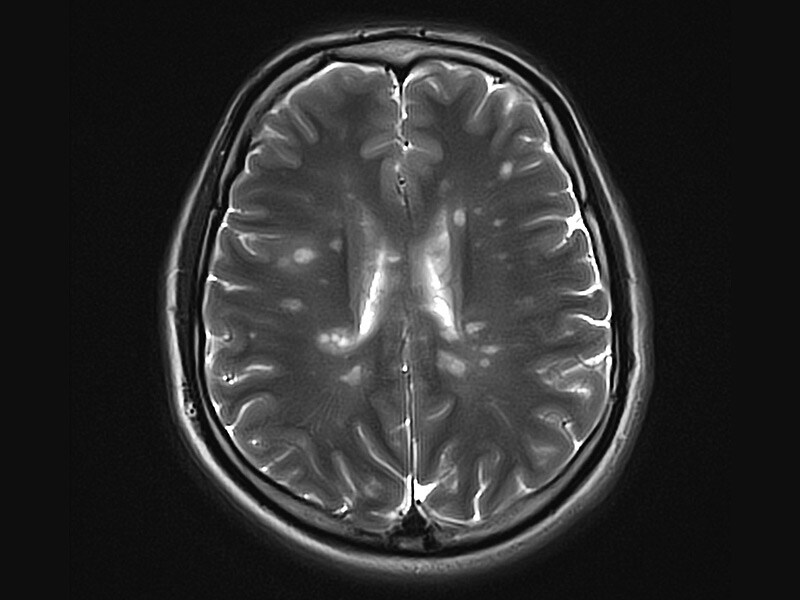 Congress of the European Committee for Treatment and Research in ...