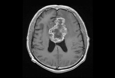 Temodar (temozolomide) dosing, indications, interactions, adverse ...
