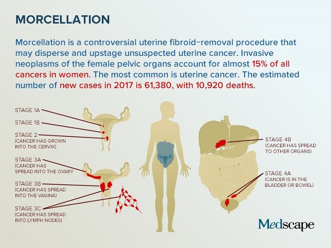 Clinical Trends for June 2017 (Transcript) - Page 4