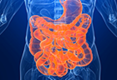 Angiodysplasia of the Colon Workup: Approach Considerations, Laboratory ...