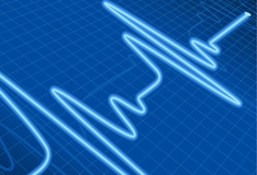 Myocardial Infarction Workup: Approach Considerations ...
