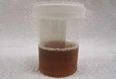 Azo Standard, Pyridium (phenazopyridine) dosing, indications ...