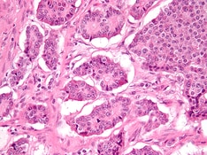 Netspot (gallium Ga 68 dotatate) dosing, indications, interactions ...