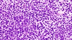 Columvi (glofitamab) dosing, indications, interactions, adverse effects ...