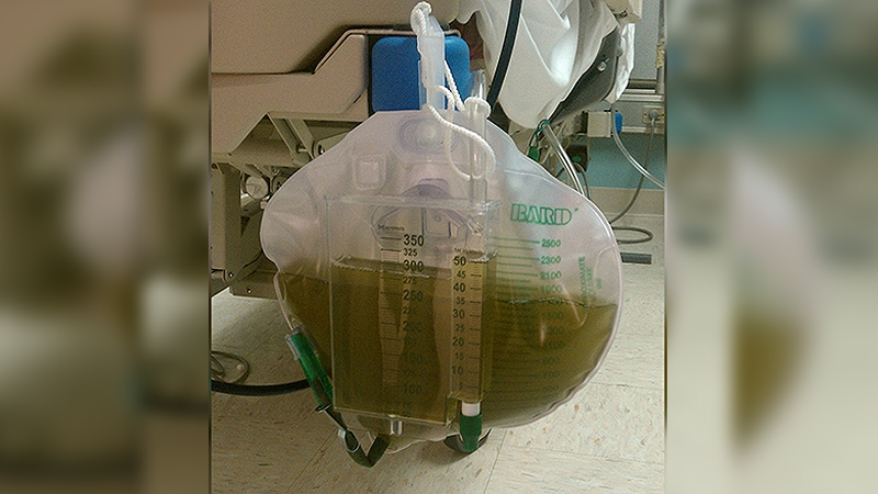 Critical Care - Medscape