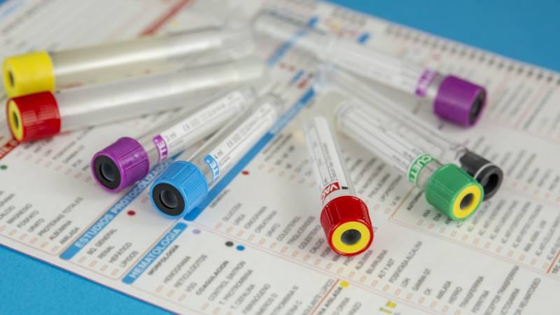 Au-delà de l'infarctus, la valeur pronostique de la troponine dans l ...