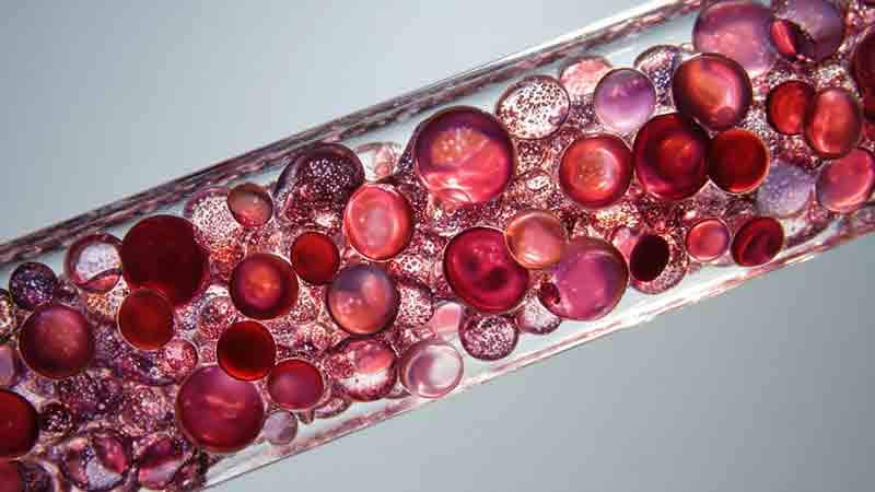 La vitesse de sédimentation arrive en bout de course