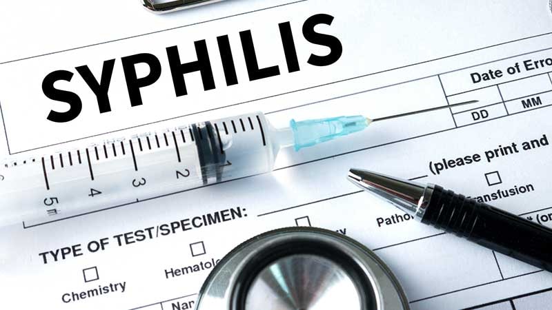 Syphilis : une seule injection suffit, même chez les patients VIH+