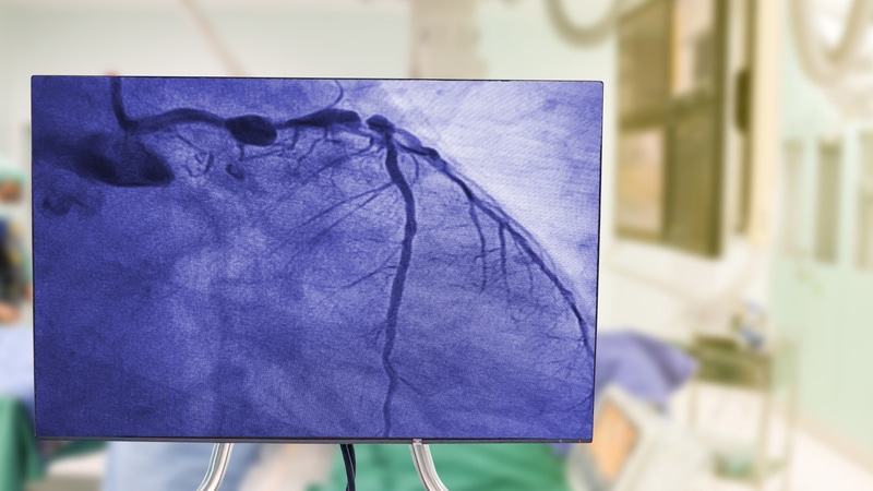 Insuffisance cardiaque FEVG- : la PCI d’une coronaire occluse améliore ...