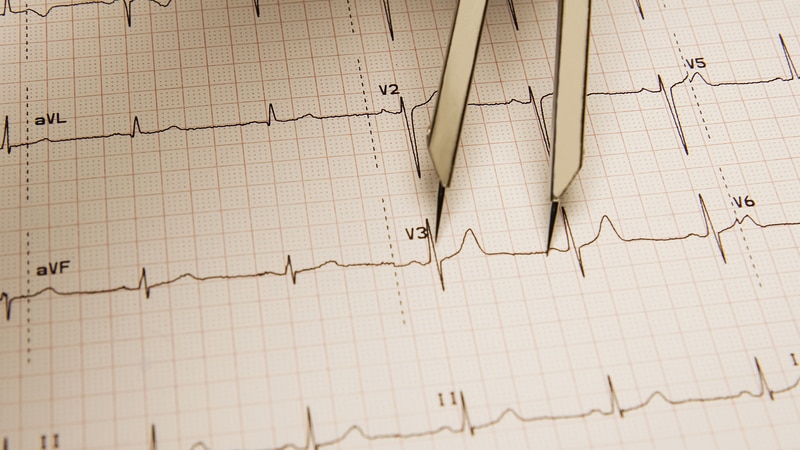 Risque cardio-pulmonaire chez le patient BPCO, un consensus d’experts